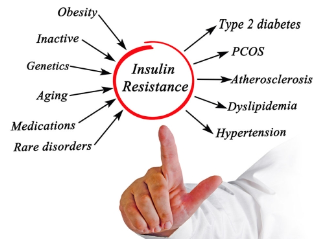 Insulin Resistance – What You Need to Know - HIVIVY
